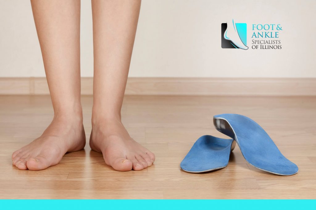Flat Feet And Fallen Arches – Foot and Ankle Podiatrists